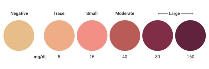 The correct way to know when you are in ketosis? - Diet keto